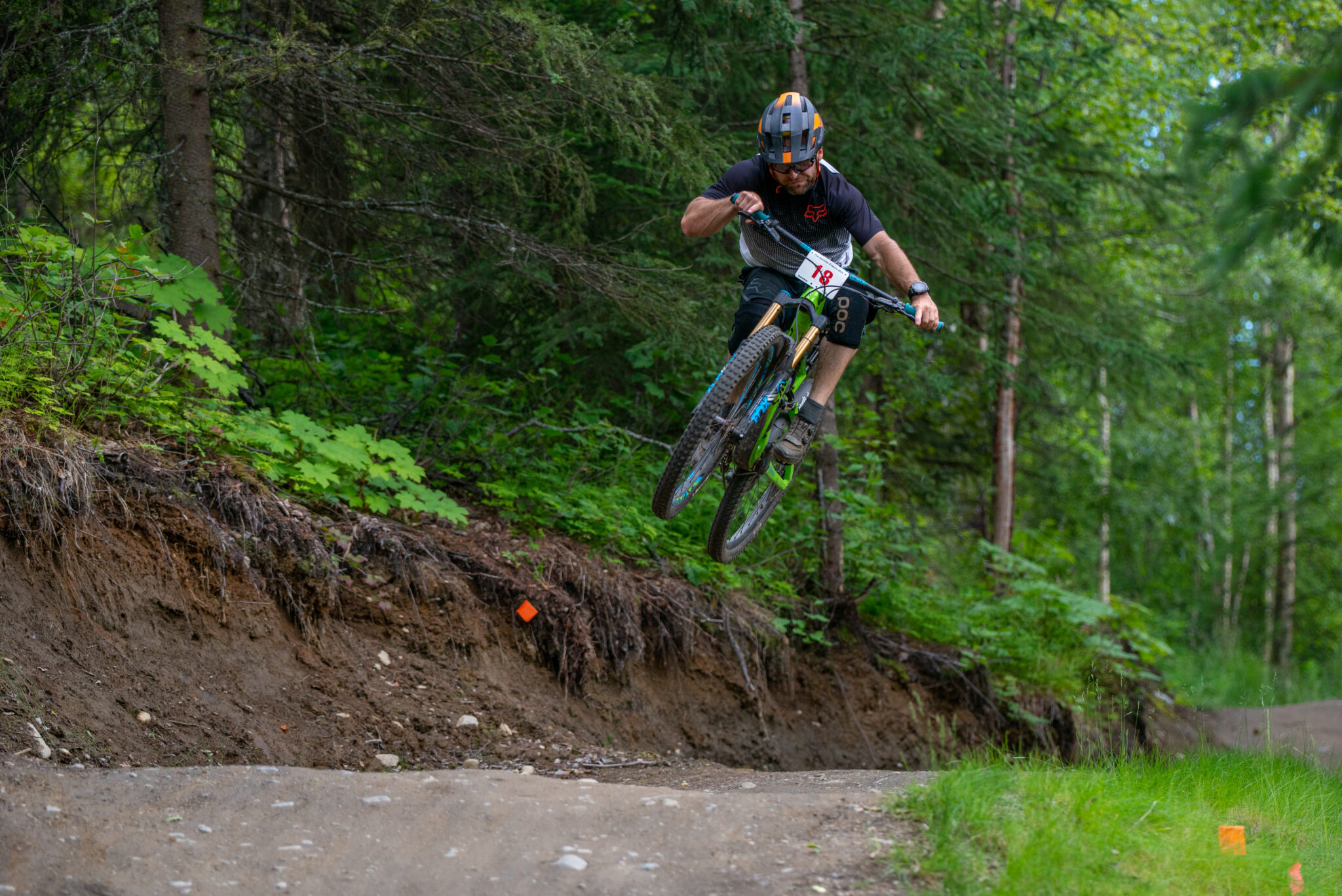 Guide to Mountain Biking Around Anchorage, Alaska - Singletracks ...